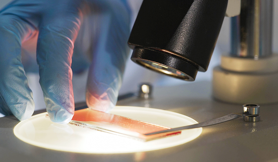 Exciting update in Sernova’s type 1 diabetes (T1D) trial | Breakthrough T1D