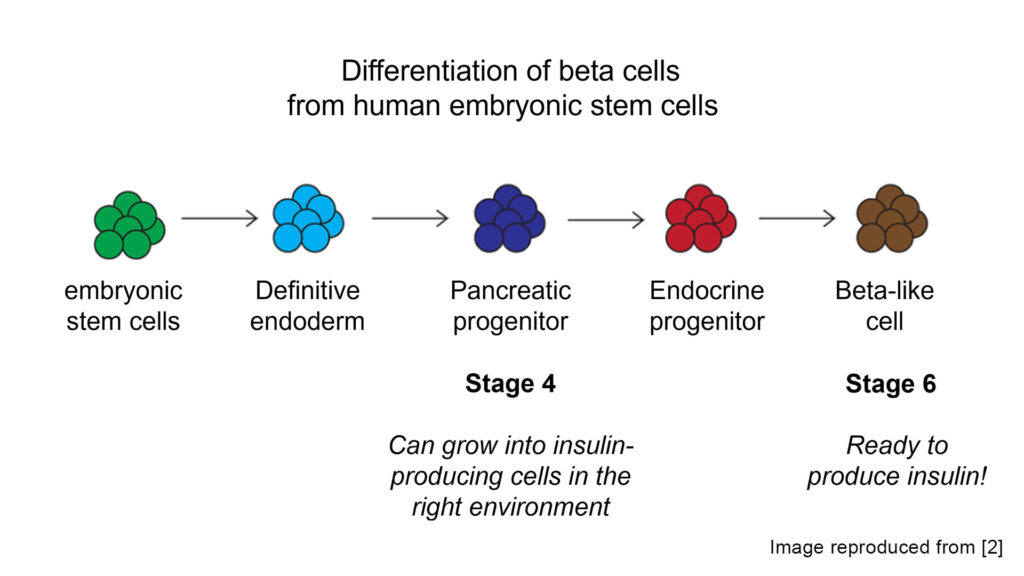 Cell Therapy | Breakthrough T1D