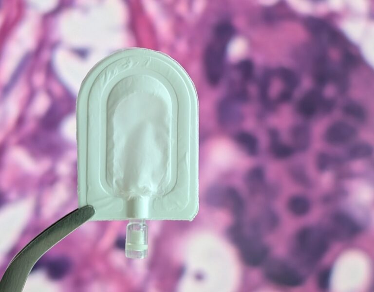 Cell therapy trial: Encellin’s device delivers promising early results ...